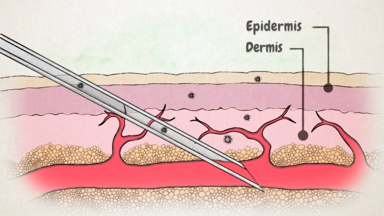 Best Practices - Better Blood Cultures